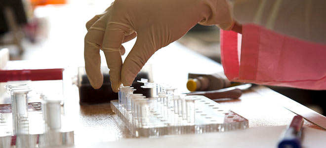 Alcohol Testing – Before You Hire, Inc.
